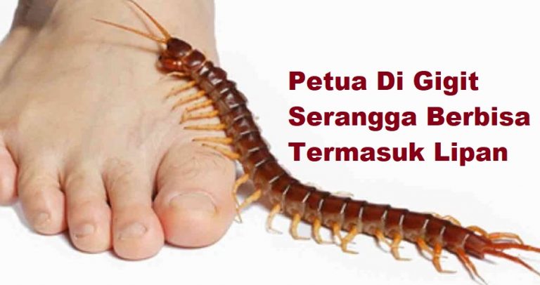Tips Petua Bila Digigit Serangga Berbisa Termasuk Lipan